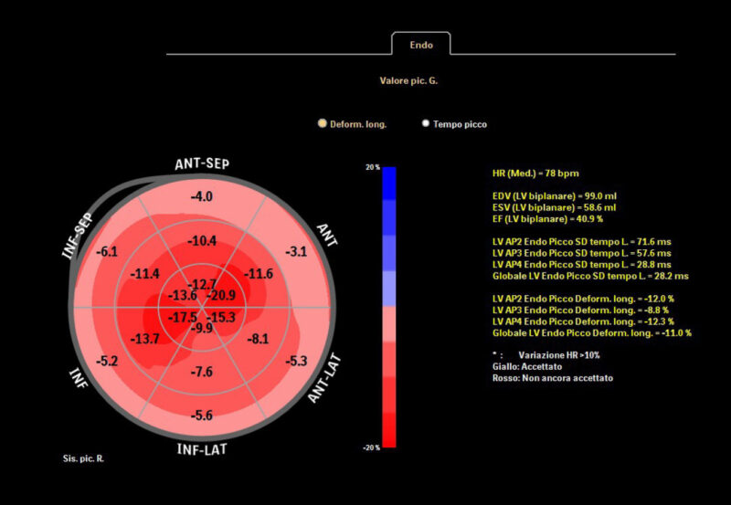 Ecocardiografia speckle tracking nella pratica clinica: a che punto ...